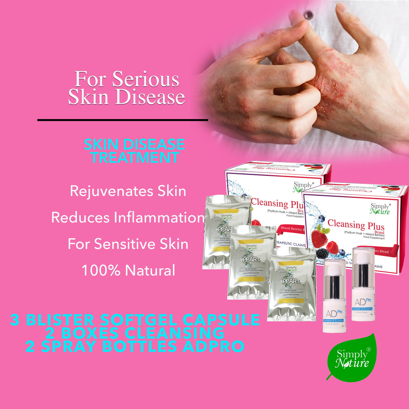 Serious Skin Disease – SimplyNature